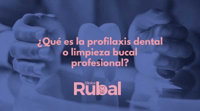¿Sabes en qué consiste la profilaxis dental y qué beneficios tiene?