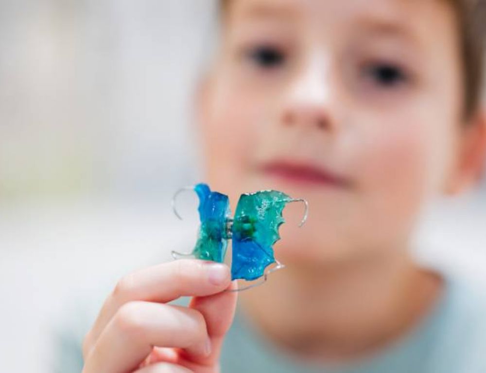 Partes de un bracket: conoce todas sus piezas