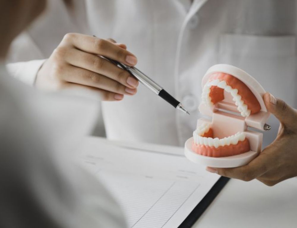 Partes de un bracket: conoce todas sus piezas