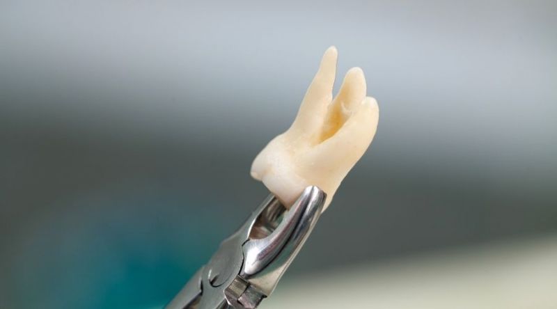 Dientes grandes o macrodoncia: causas, diagnóstico y soluciones - Rubal ...
