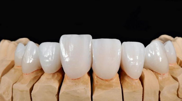 Dientes grandes o macrodoncia: causas, diagnóstico y soluciones - Rubal ...